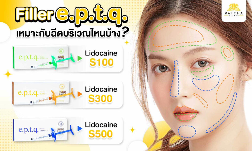 ฟิลเลอร์ e.p.t.q. ดีไหม มีกี่รุ่น ฉีดบริเวณไหนได้บ้าง