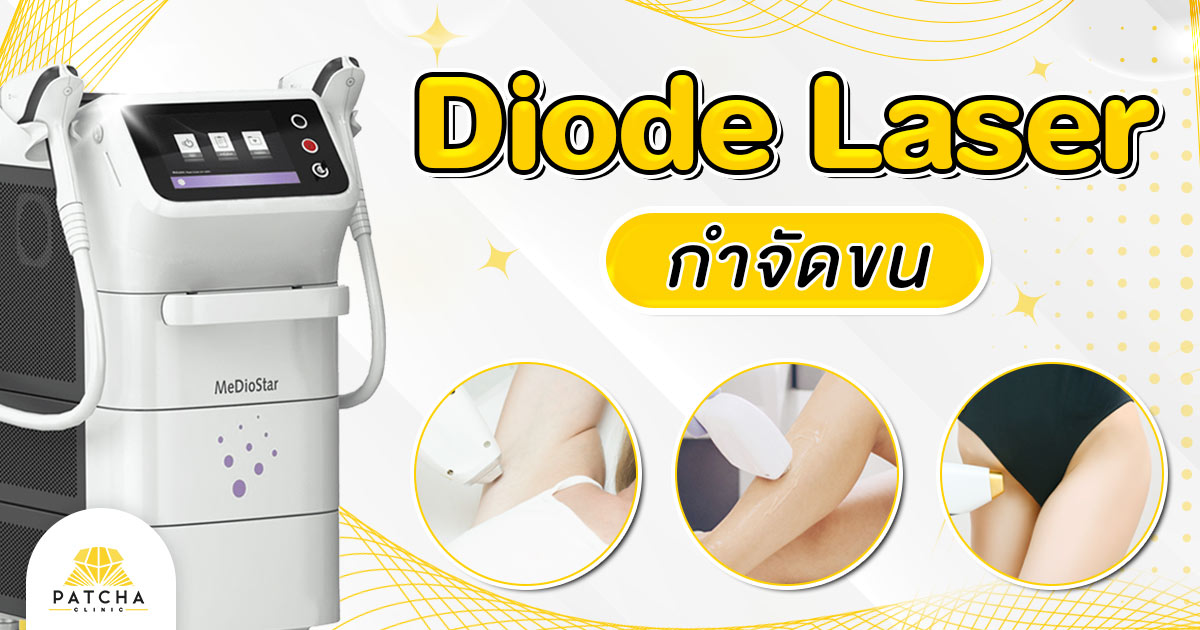กำจัดขนด้วย Diode laser ดีไหม บอกลาเส้นขนอย่างถาวรได้จริงไหม
