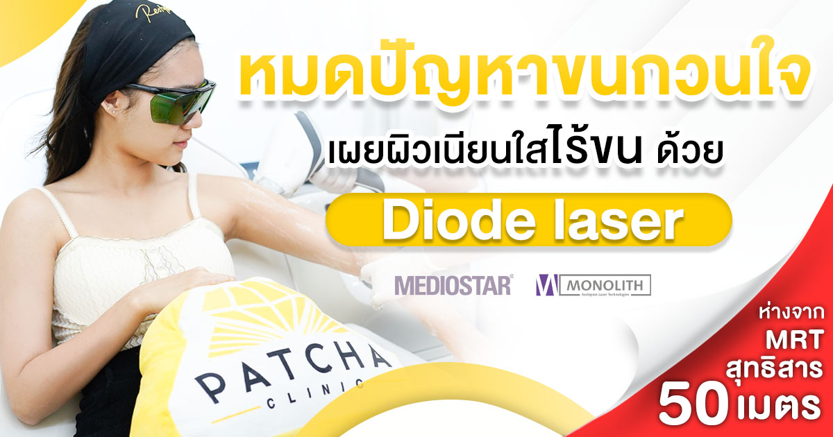 เลเซอร์ขน | Patcha Clinic