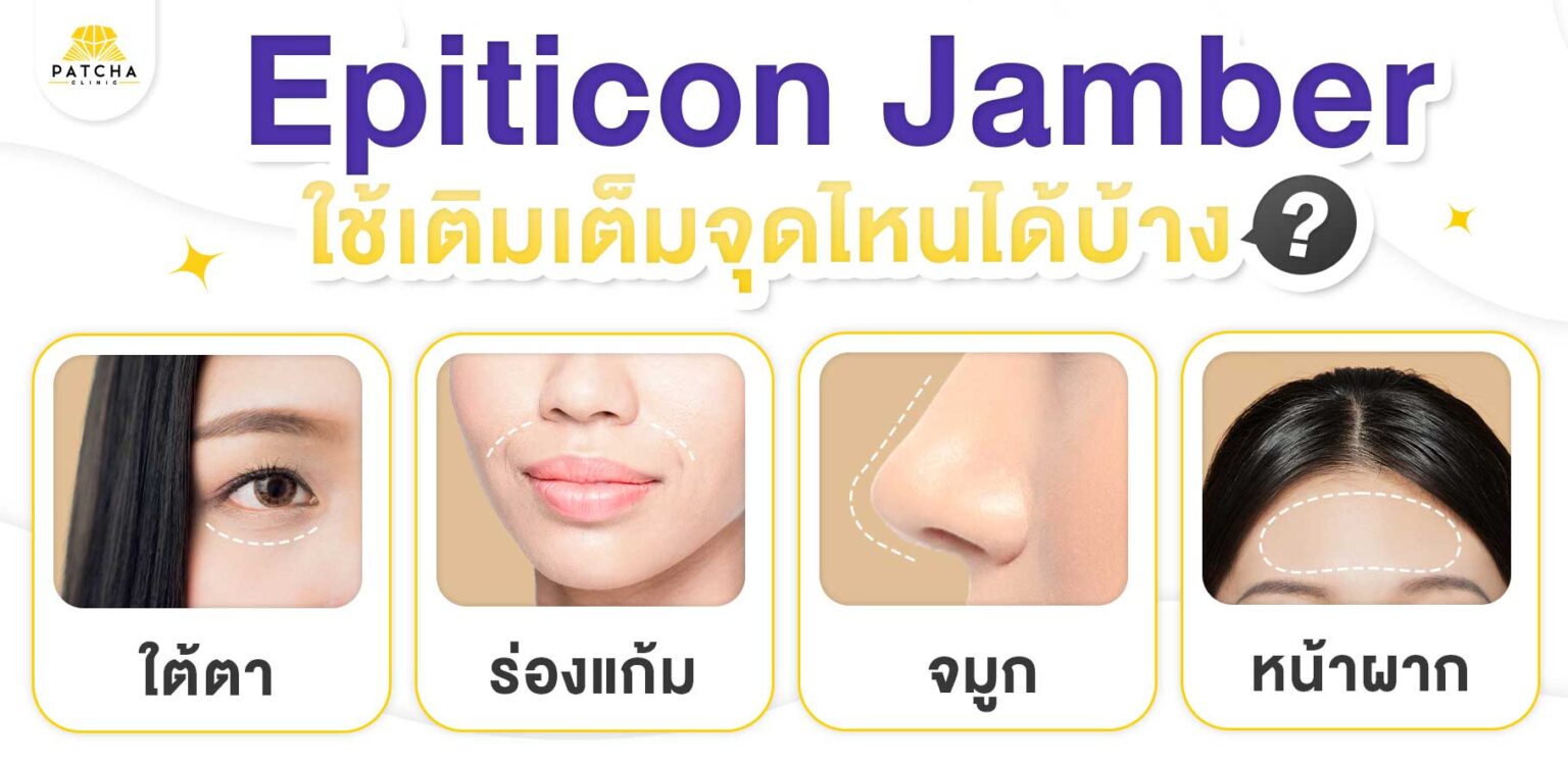 ไหม Epiticon คืออะไร ดีไหม มีกี่แบบ