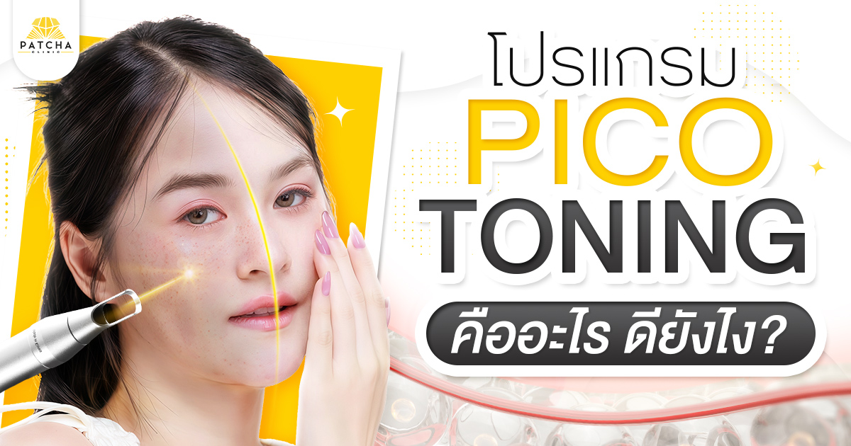 Pico Toning คืออะไร ดียังไง หลังทำมีความเปลี่ยนแปลงไหม